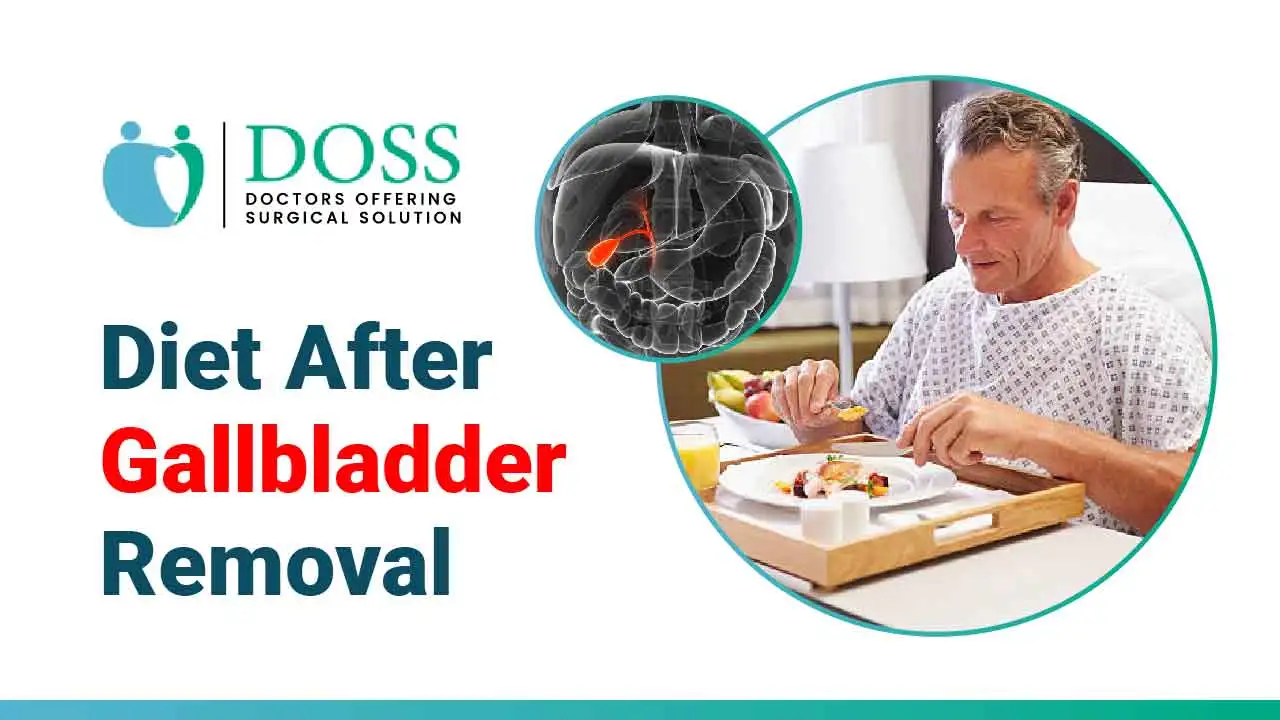 What Should Be The Diet Post Gallbladder Surgery Doss India