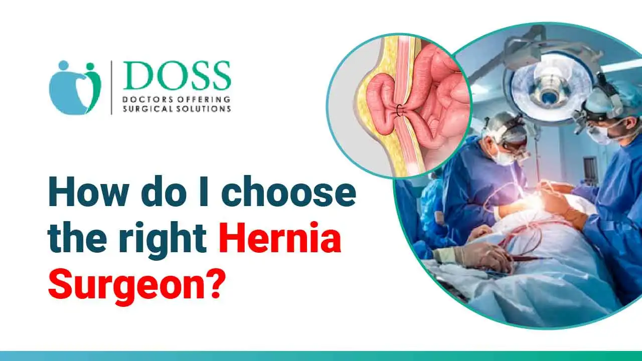 How do I choose the right hernia surgeon? | Doss India